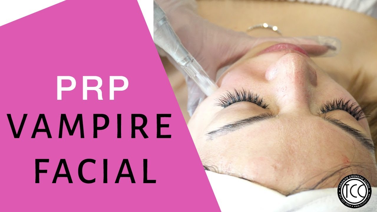 Platelt Rich Plasma Face Therapy - YouTube