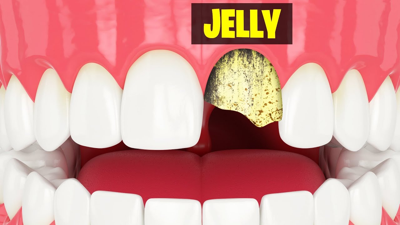 Hiding As ROTTEN TEETH! (Gmod Prop Hunt) - YouTube