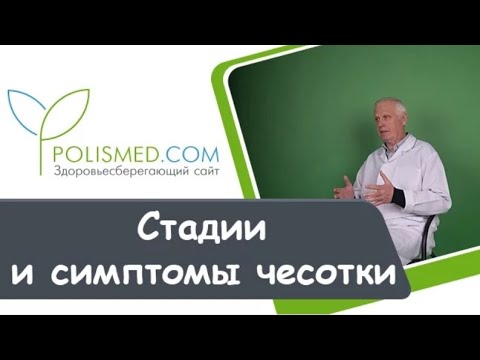 Стадии и симптомы чесотки: высыпания, зуд, температура. Запущенная чесотка