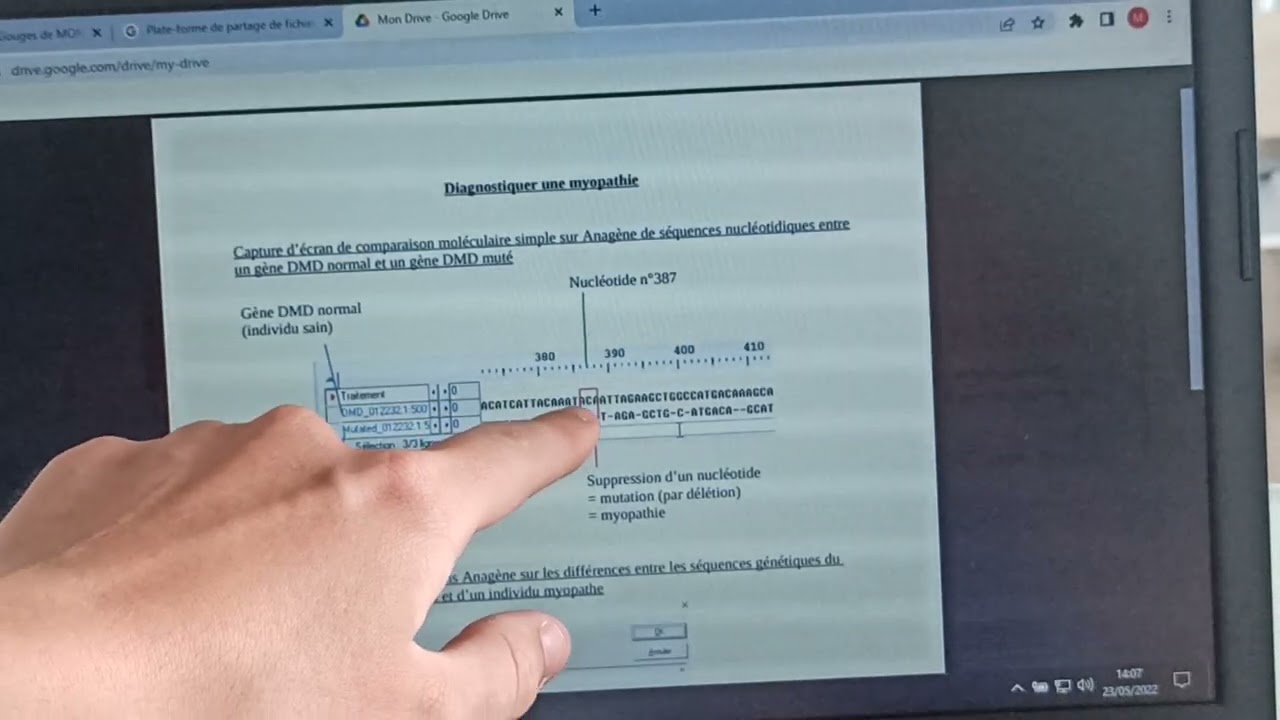 Utilisation d'Anagène pour comparer des allèles de gènes impliqués dans ...