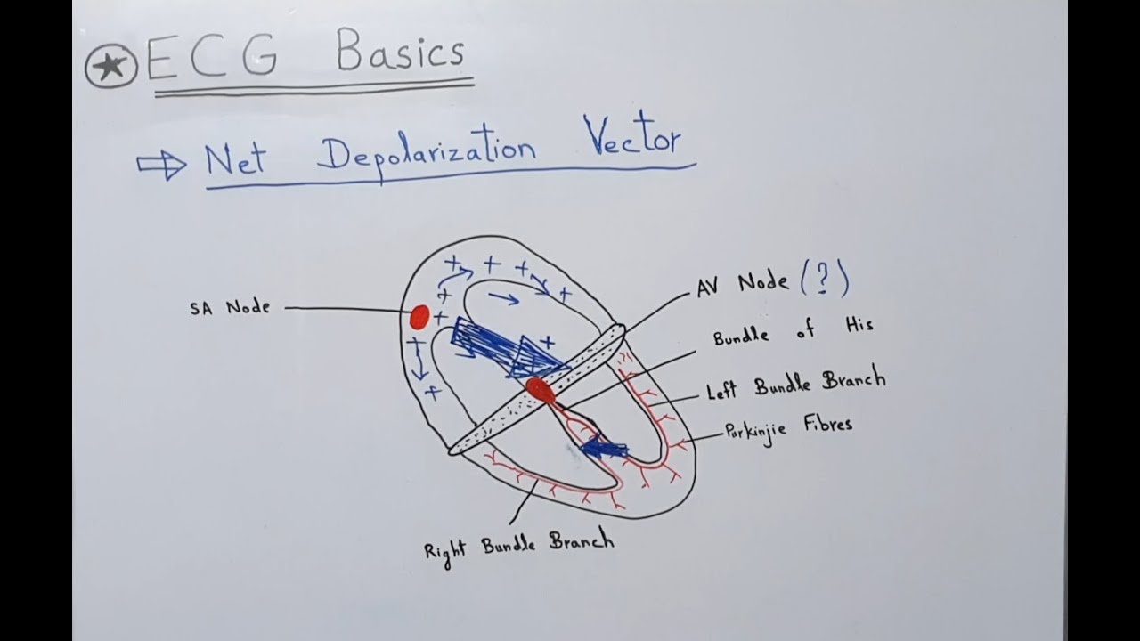 ECG Basics - Net Depolarization Vector (Average Direction of Flow of ...