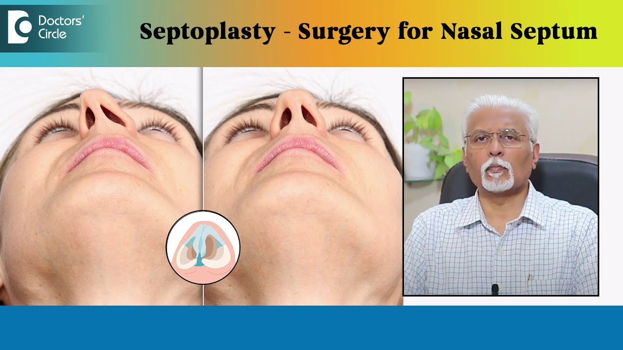 SEPTOPLASTY - Deviated Septum Surgery for breathing difficulty - Dr ...
