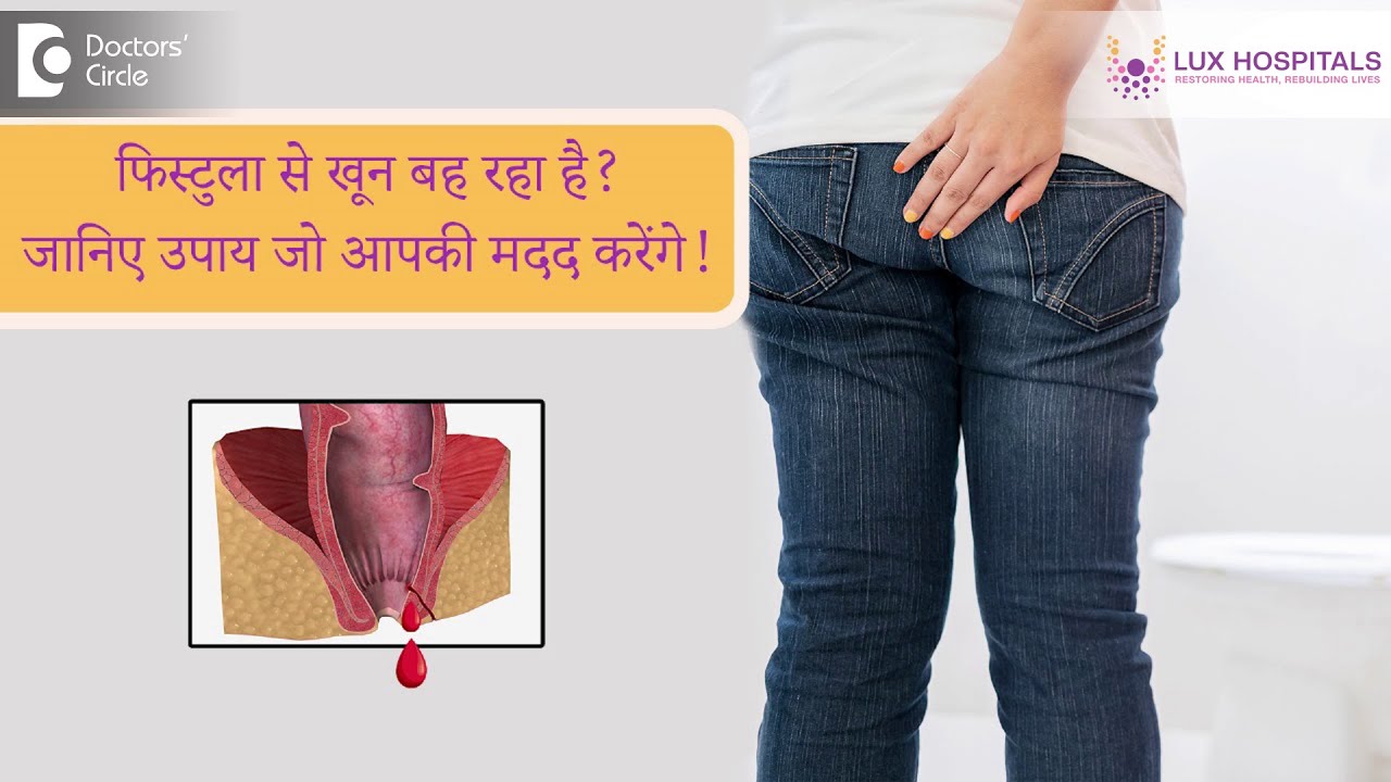 फिस्टुला ब्लीडिंग को कैसे रोकें?| Bleeding from Bottom -डॉ. समहिता ...