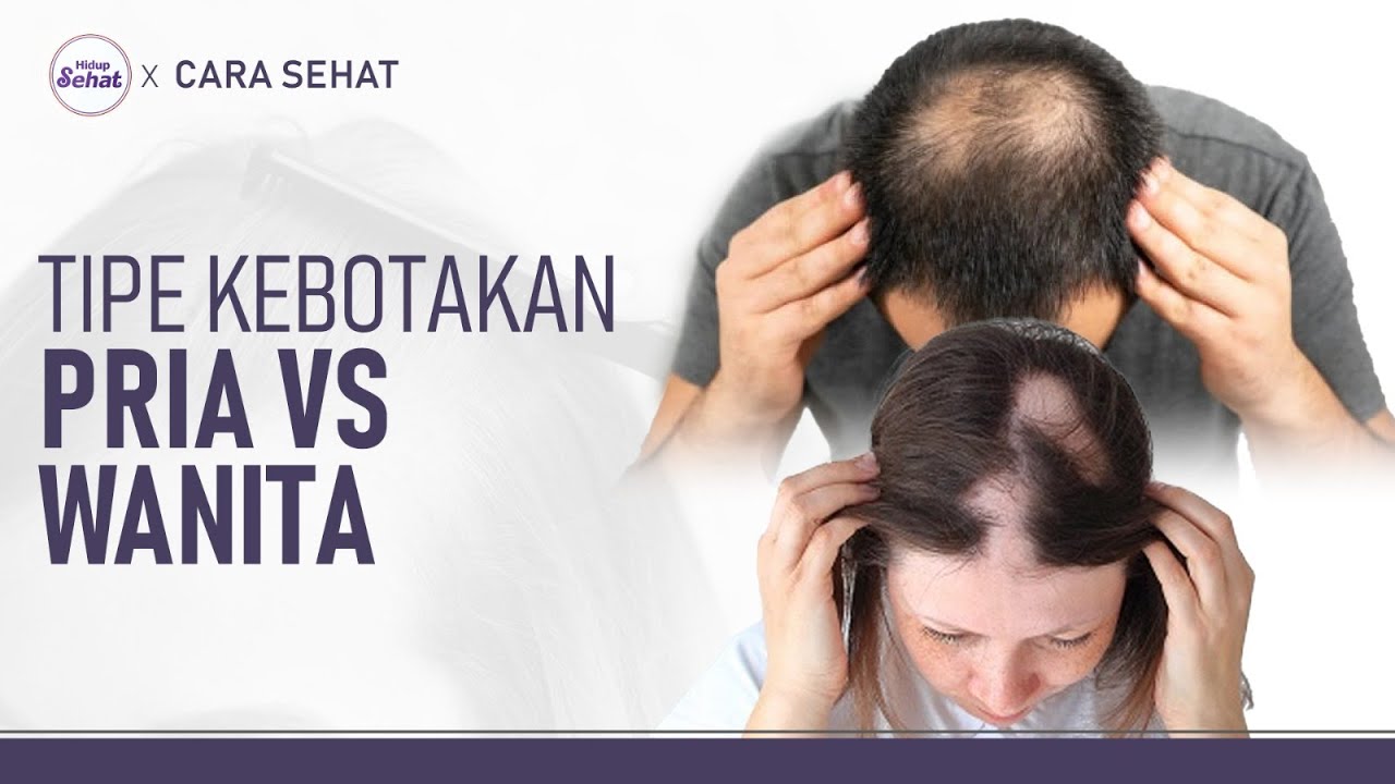 Penyebab Kebotakan Pria dan Wanita Berdasarkan Tipenya | Hidup Sehat tvOne - YouTube