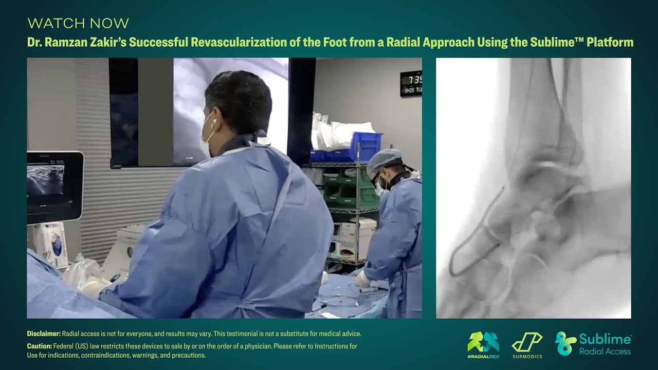 Dr. Ramzan Zakir’s Pedal Loop Revascularization from a Radial Approach ...