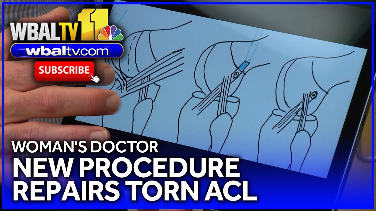 Woman's Doctor: LET procedure helps repair torn ACL - YouTube