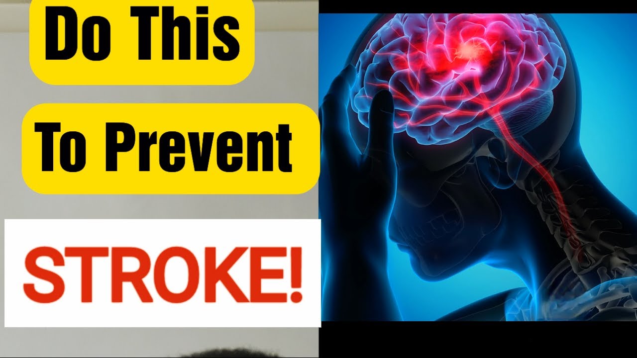 The Best Ways To Prevent a Stroke/ Reduce Your Stroke Risk - YouTube