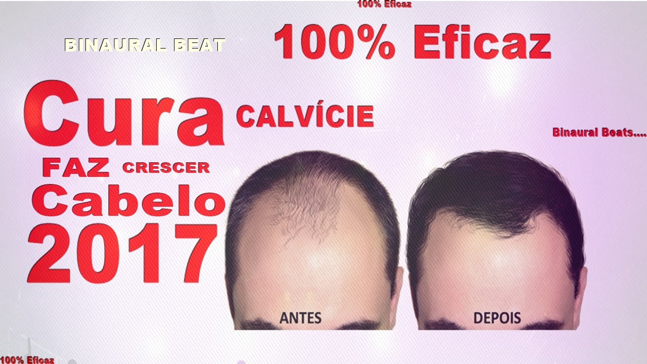 Calvície Cura Como Curar Calvície 100% com BINAURAL BEAT - YouTube