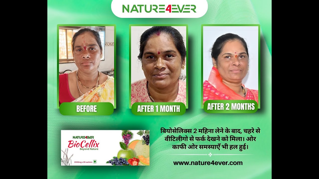 BioCellix by Nature4Ever: The Ultimate Anti-Aging Solution for Hairfall ...