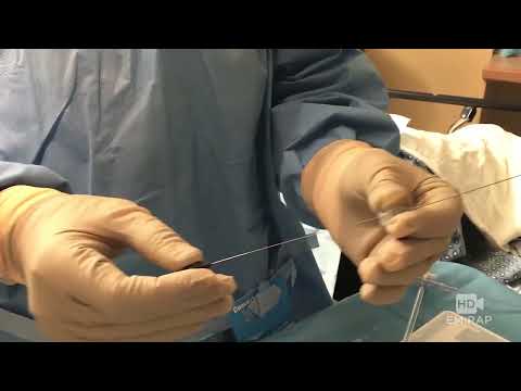Lumbar Puncture Tutorial