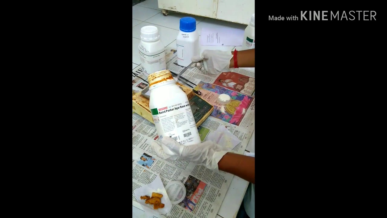 Preparation of Baird Parker Agar. - YouTube