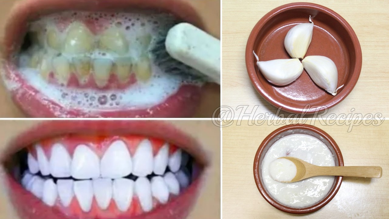 Teeth whitening at home | How to whiten teeth naturally | Teeth ...