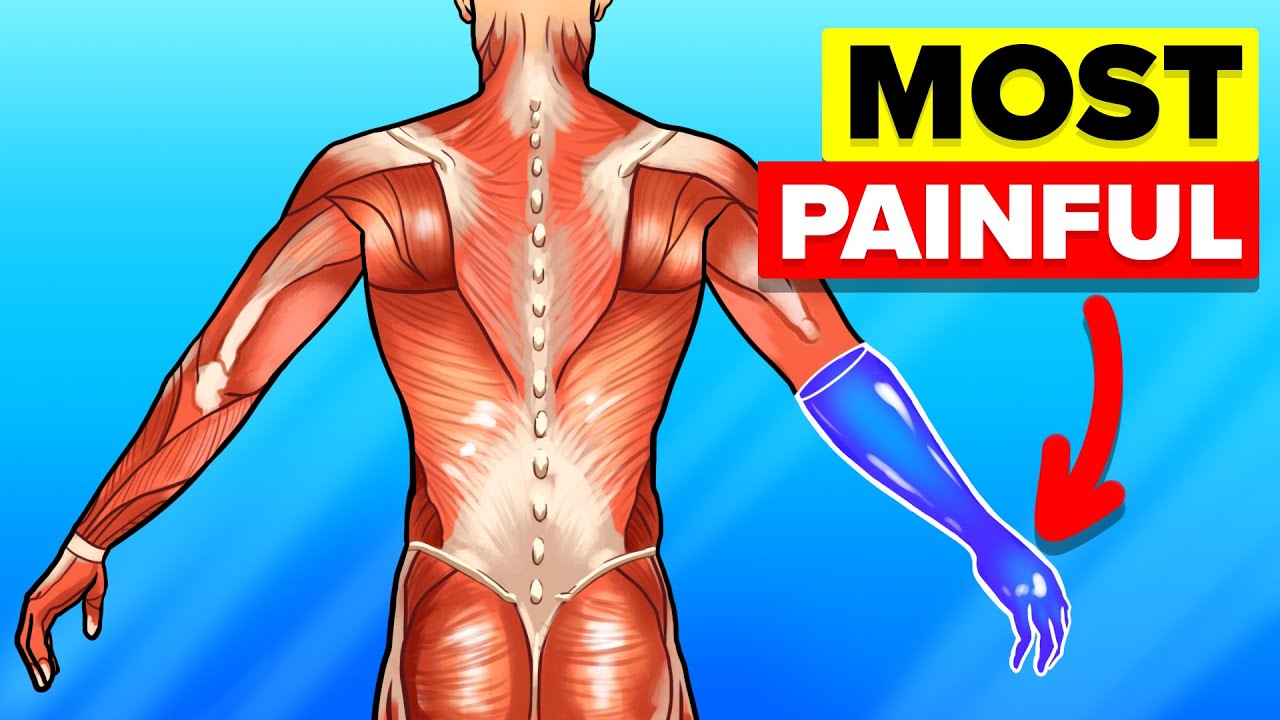 What Does it Actually Feel Like to Lose an Arm - YouTube