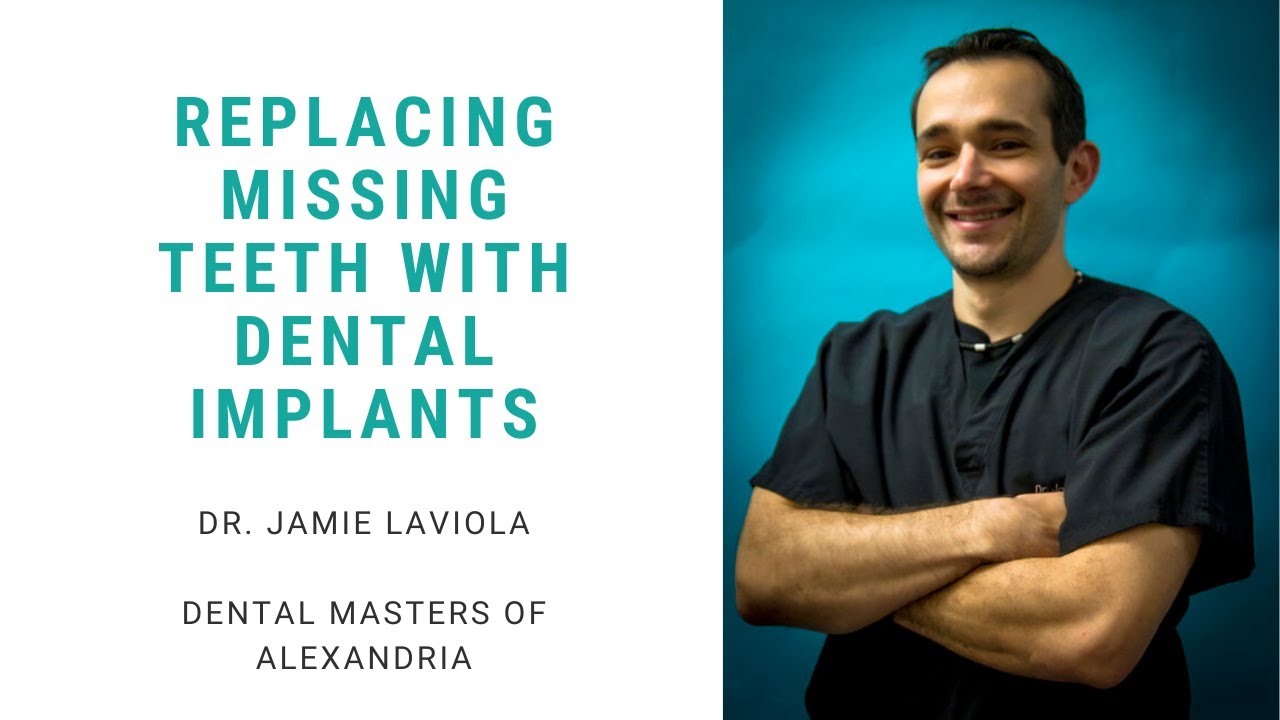 Replacing Missing Teeth with Dental Implants | Dr. Jamie LaViola on The ...