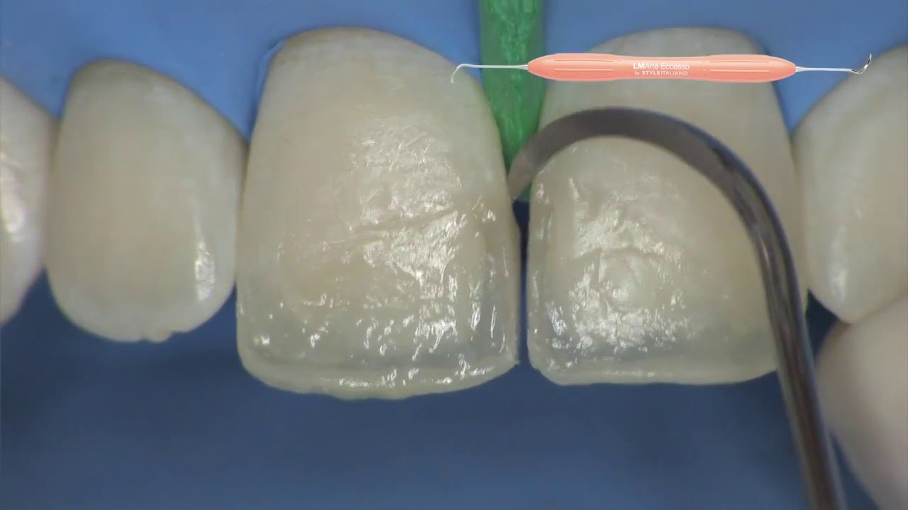 LM-Arte Eccesso - YouTube