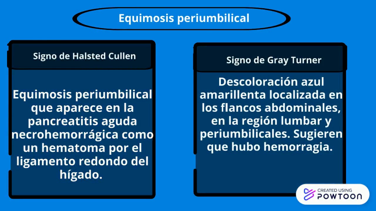 Exploración física (Pancreatitis aguda y crónica) - YouTube
