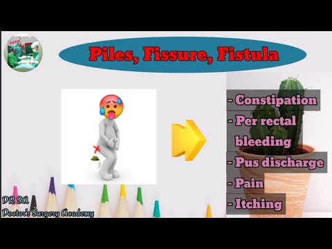 What is Piles ? | Haemorrhoid | Fissure | Fistula | #DRSA - YouTube