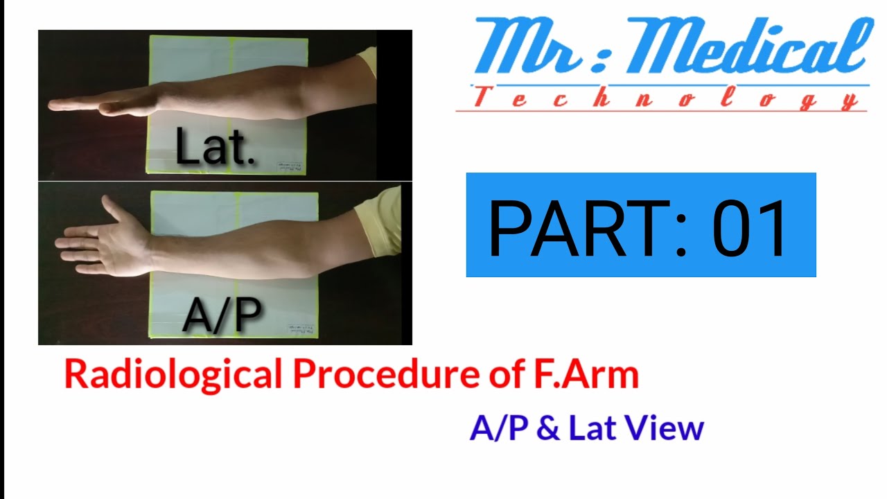 RADIOLOGICAL PROCEDURE OF FORE ARM (A/P & LAT.) VIEW ।। Mr. Medical ...