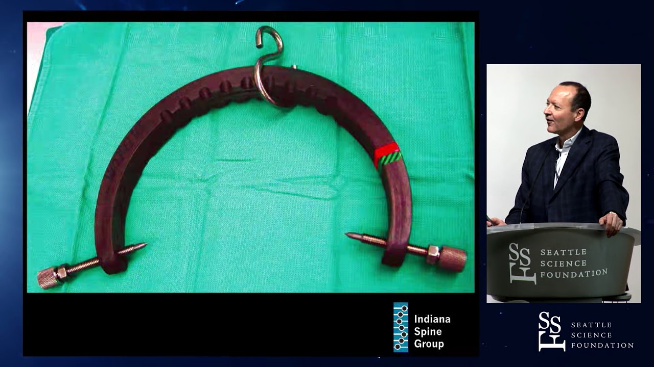 The Dislocated Subaxial C Spine: Reduce First or MRI First - Rick Sasso ...