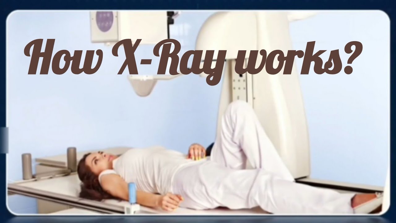 how x-ray machine works ? | How X-Ray Machine Reads The Body | X-ray ...