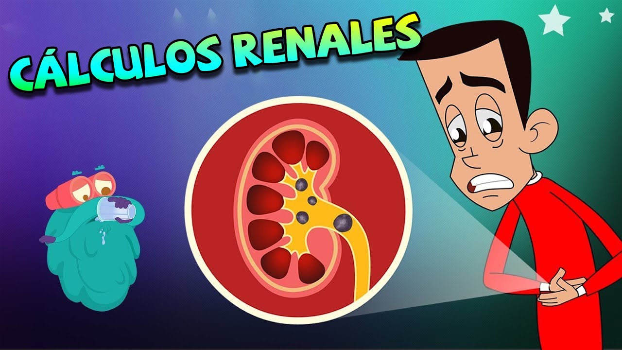 Cálculos Renales y lo que debes saber | Educativos para niños - YouTube