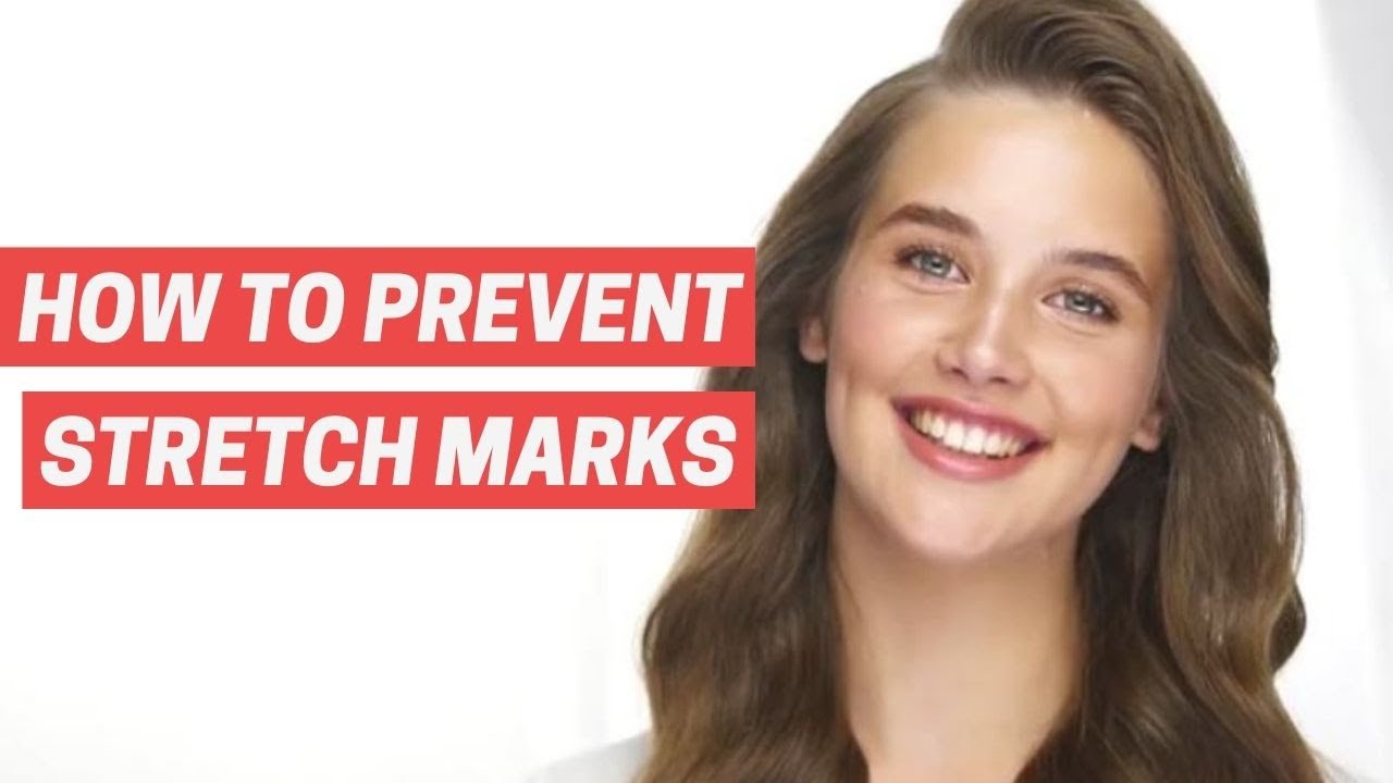Prevent Stretch Marks - How to Prevent Stretch Marks - YouTube