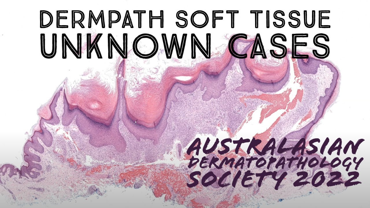 Dermpath Soft Tissue Unknowns - 12 Cases for Australasian ...