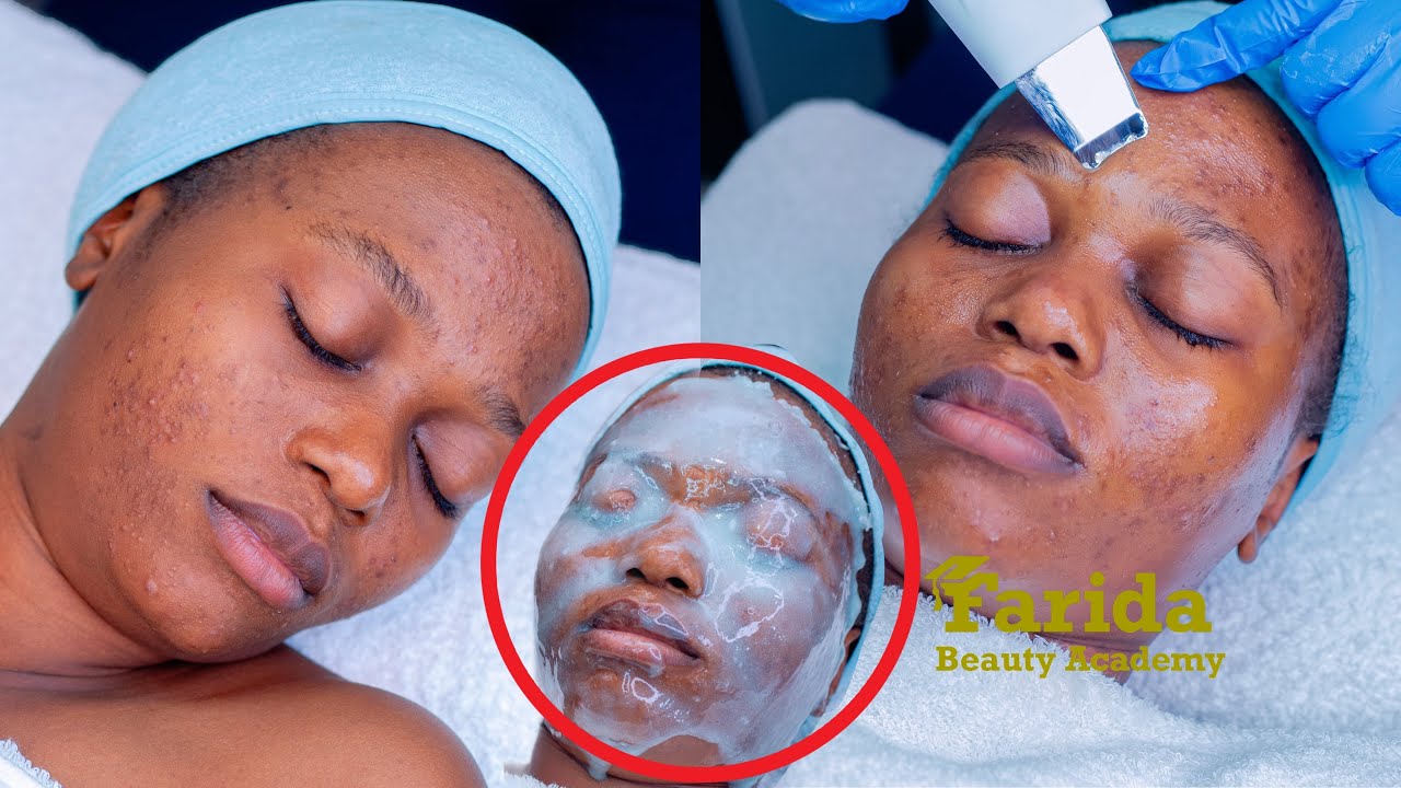 Njia sahihi ya KUONDOA CHUNUSI USONI / MADOA na NGOZI ILIYOKOSA NURU ...