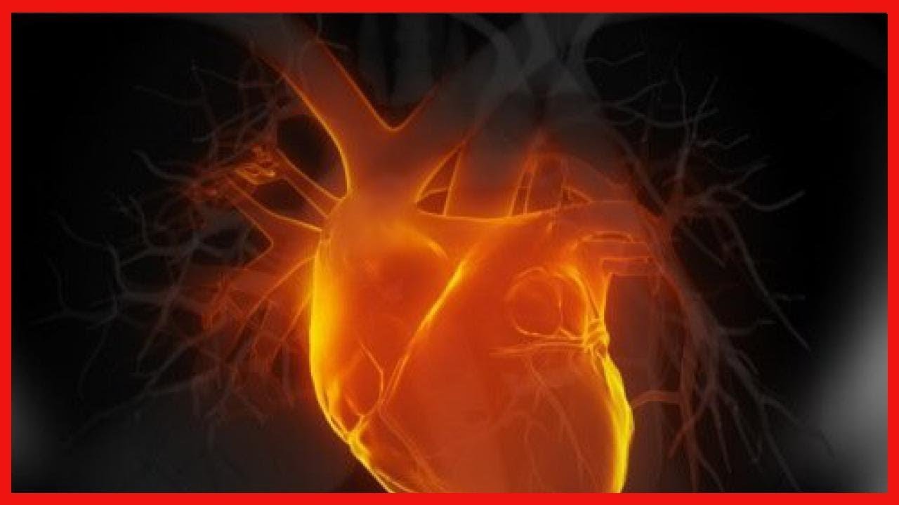 ¿Cuáles son los síntomas de un preinfarto? - YouTube