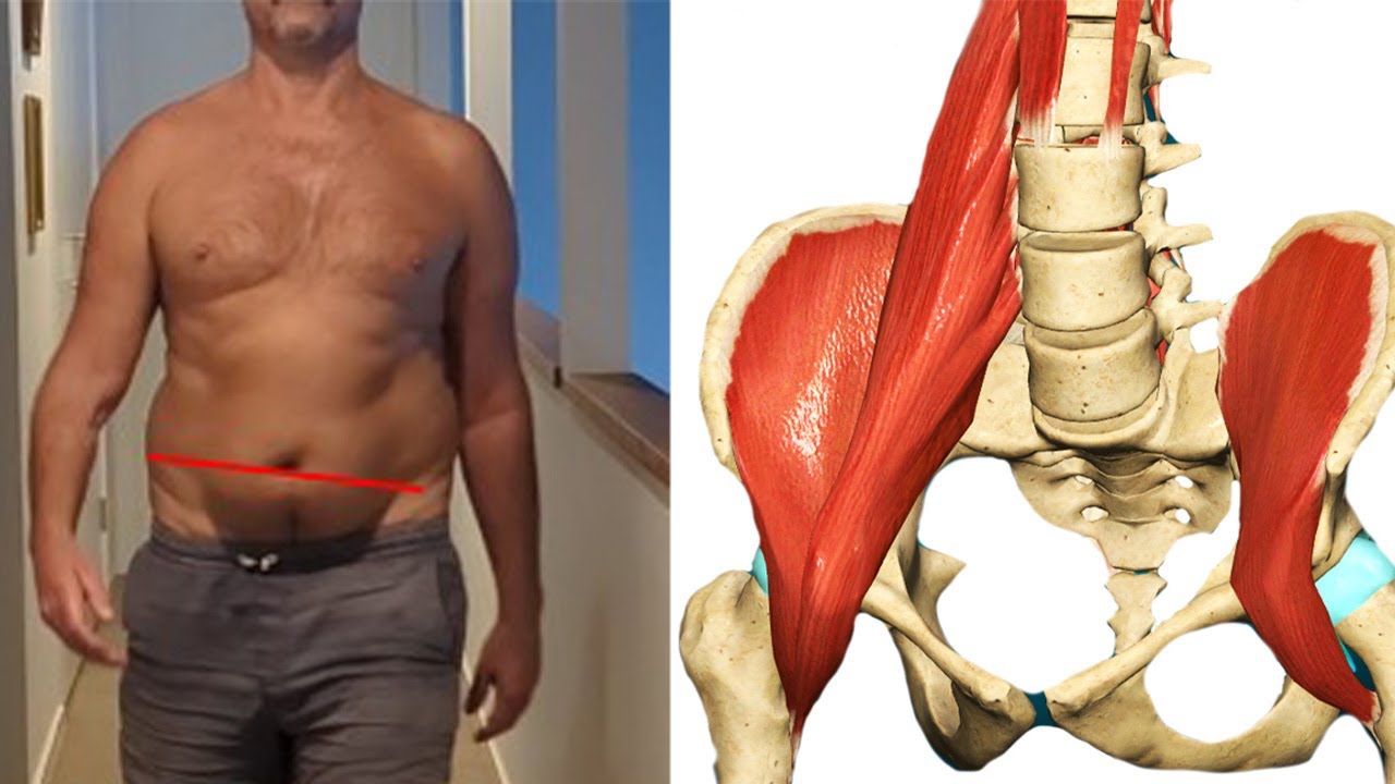 One-Sided Psoas Pain & Pelvis tilt SOLUTION (2 exercises to fix Left ...