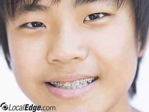 Reynolds Orthodontics Greensboro NC - YouTube