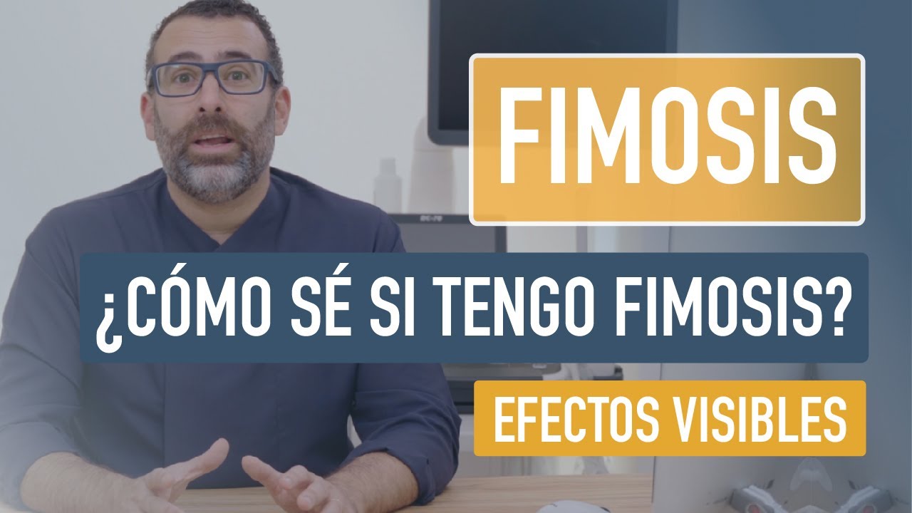 ¿Qué es la Fimosis y Parafimosis? ¿Cómo sé si tengo Fimosis? Dr ...