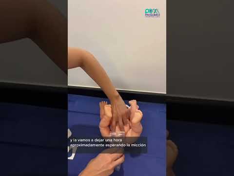 ¿Cómo recolectar una muestra de orina para pacientes pediátricos?