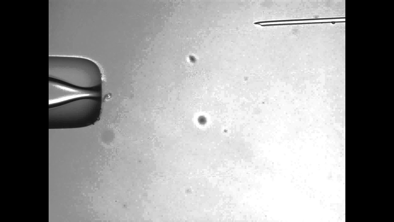 ICSI Procedure - YouTube