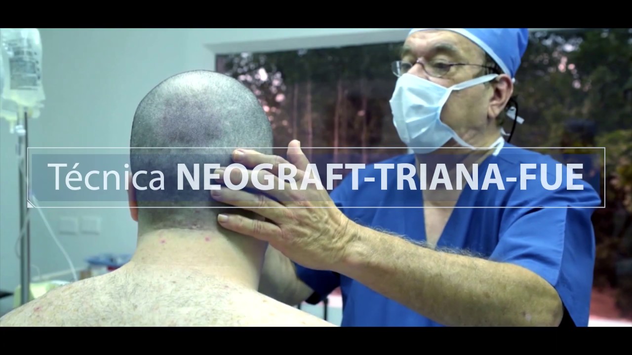 PROCEDIMIENTO IMPLANTE CAPILAR- DR TRIANA - YouTube