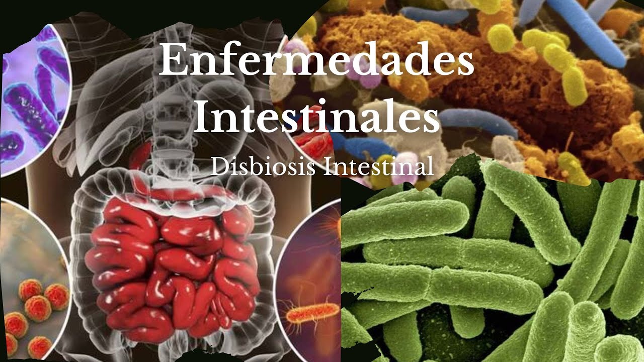 ENFERMEDADES INTESTINALES - YouTube