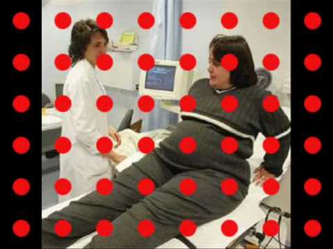 La obesidad en las mujeres embarazadas mexico. - YouTube