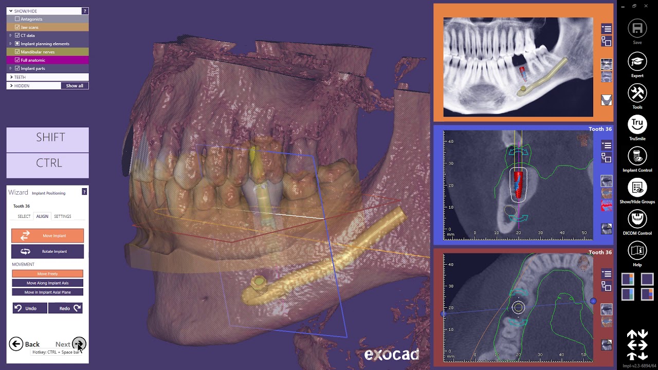 exoplan including Guide Creator - Basic tutorial - YouTube
