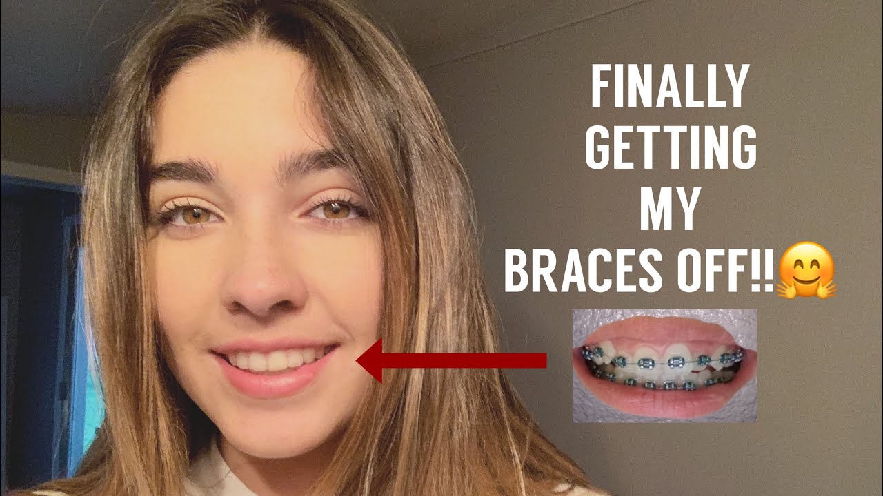 FINALLY GETTING MY BRACES OFF!!!😱🤯 - YouTube