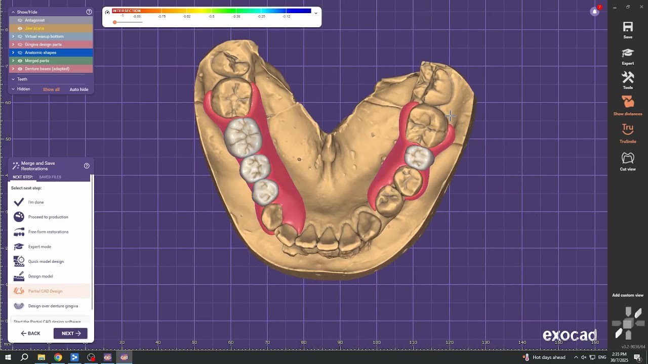 Exocad Flexible Denture Design For Lower Arch Split Base @ 2 Base - YouTube
