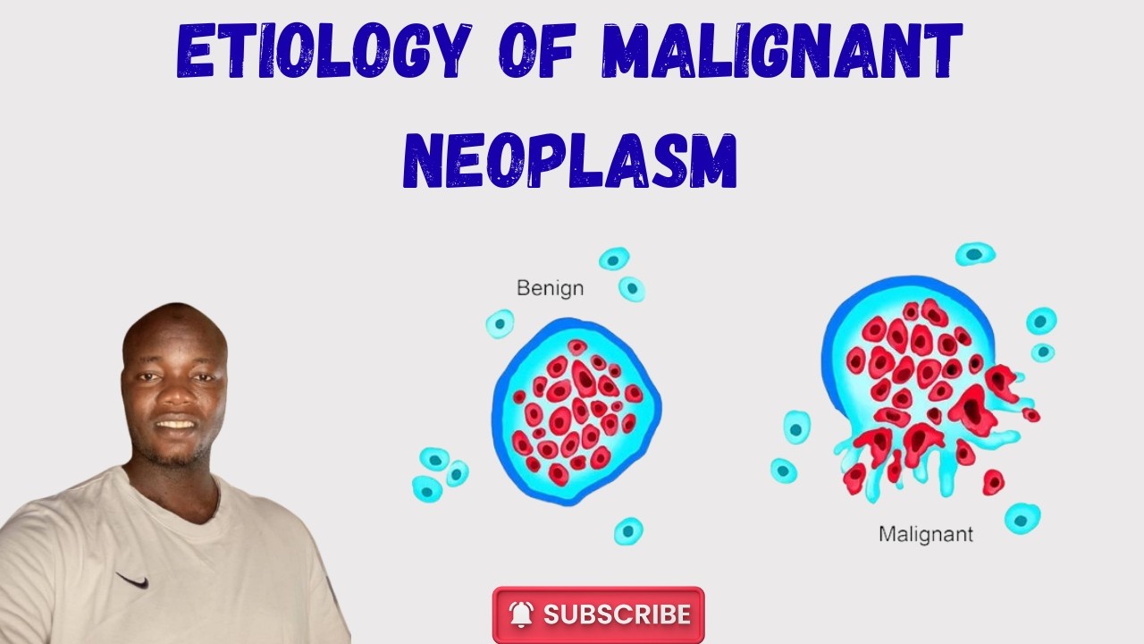 Etiology of Malignant Neoplasm - YouTube