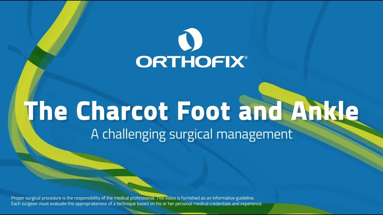 The Charcot Foot and Ankle - A challenging surgical management - YouTube