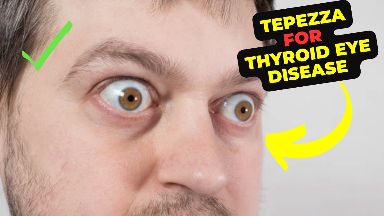 The Unveiling of Tepezza: Exploring its Side Effects and Safeguarding ...