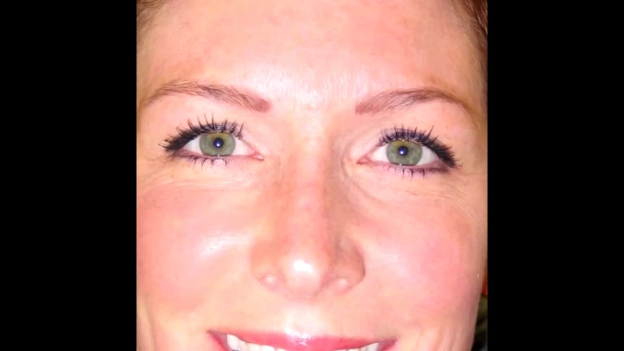 Deluxe Skin Tag And Mole Remover On Sale – Pleasures Of Life - YouTube