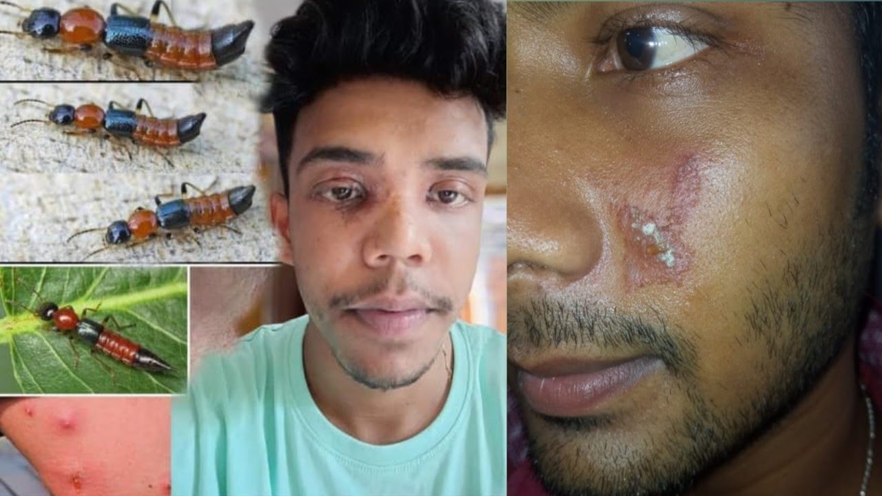 Acid poka acid poka viral video acid poka Hostel Siliguri hotel Acid ...