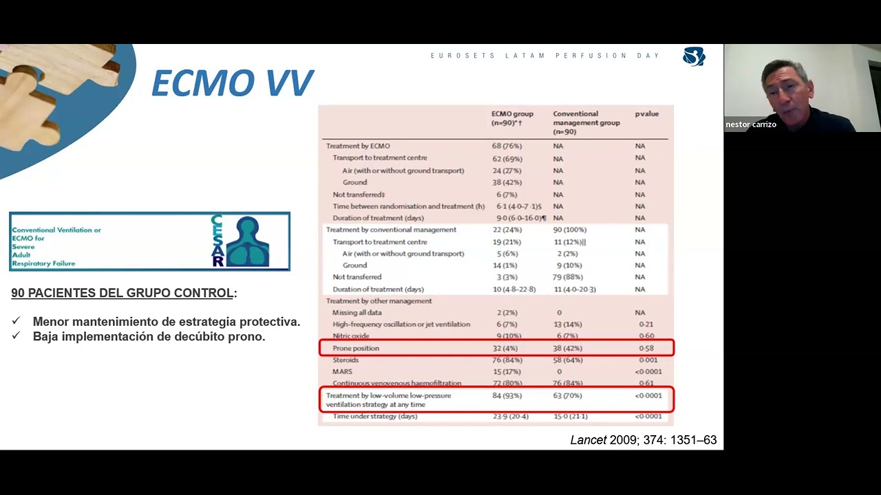 ECMO Club Day II - Eurosets VA (Veno Arterial) - YouTube