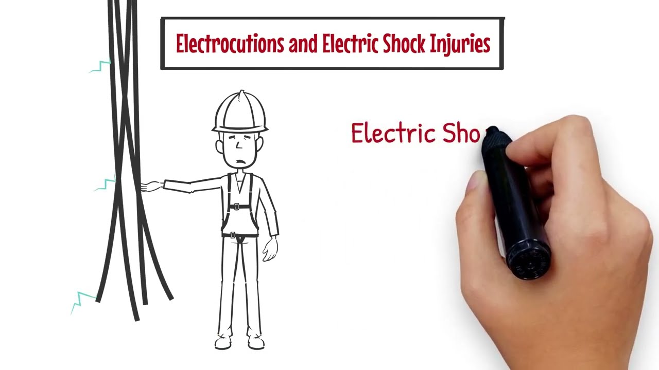 Electric Shock Injuries Electrical Injuries: Management Of Low Voltage