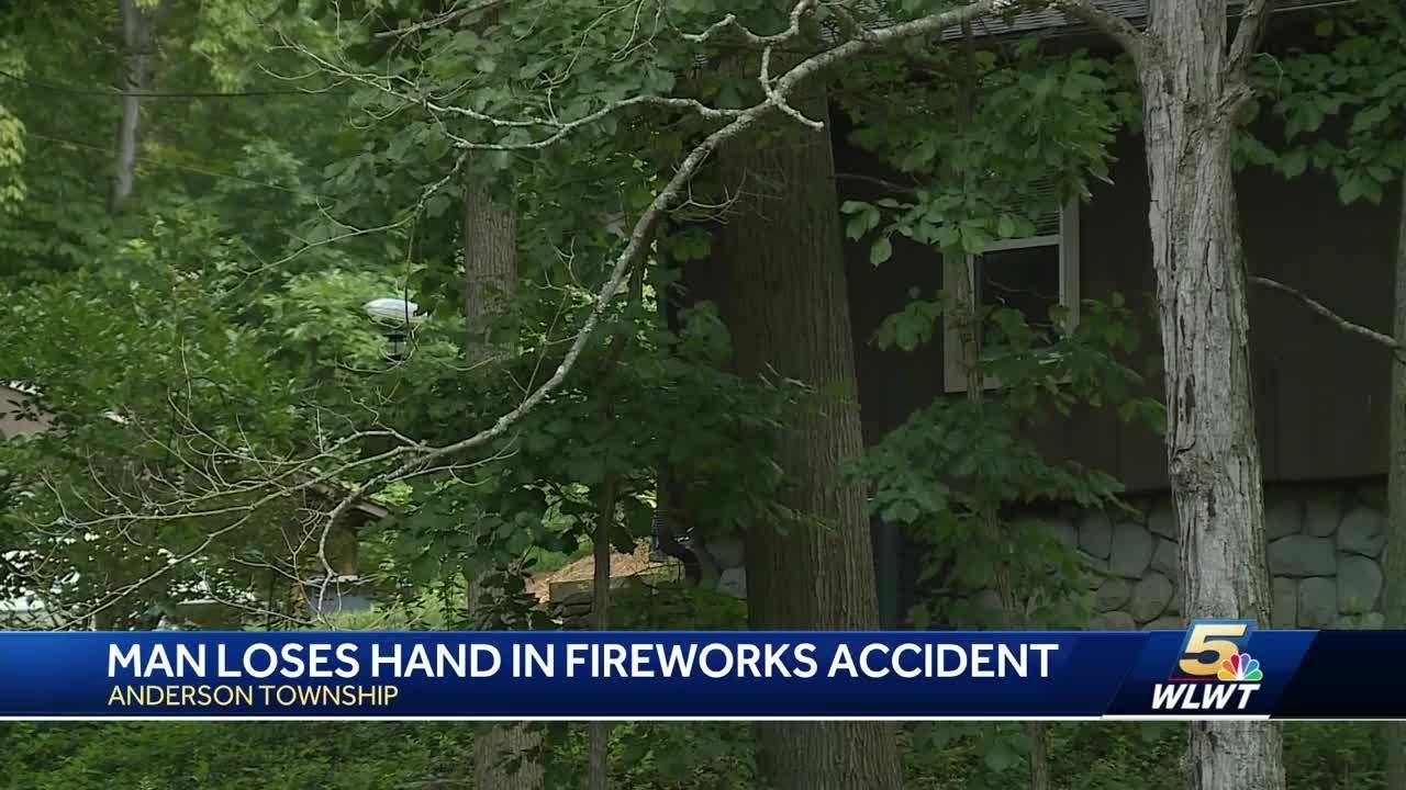 Man loses hand in fireworks accident - YouTube