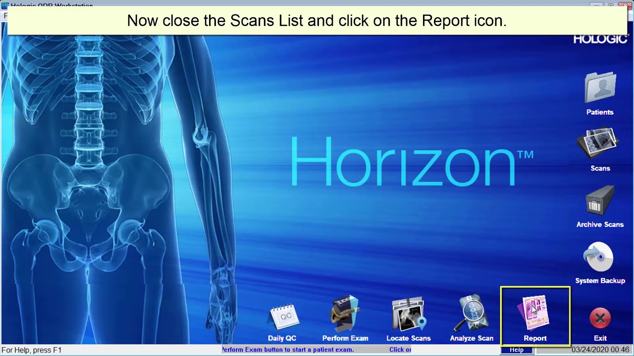 Transferring Scans From Hologic - YouTube