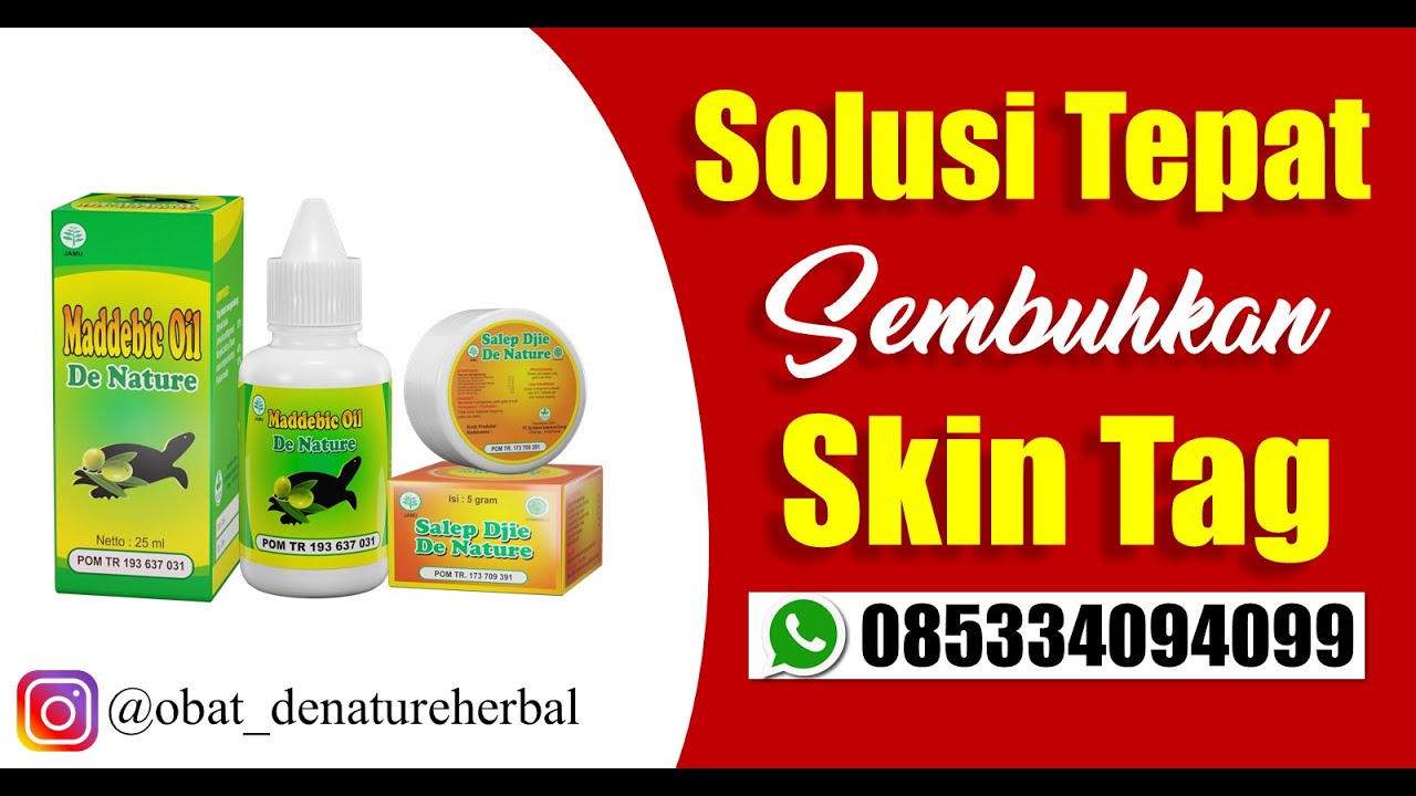 OBAT SKIN TAG AMPUH AMAN TANPA EFEK SAMPING - SOLUSI TEPAT ATASI SKIN ...